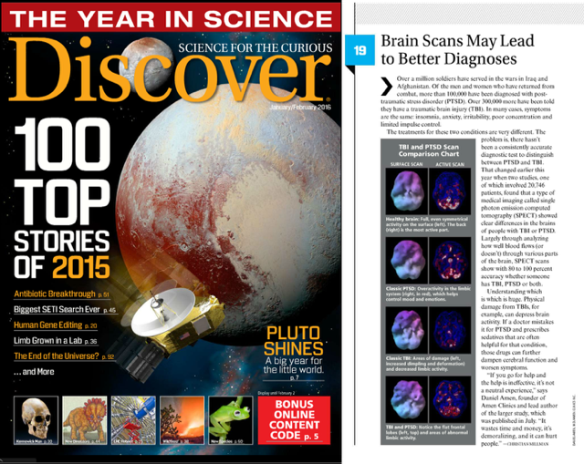 Discover Magazine’s Top Discovery of the Year Goes To… - Neuro-Laser ...