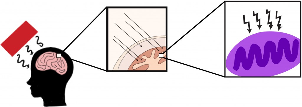 Near-Infrared Light Regenerates Damage from Traumatic Brain Injury ...